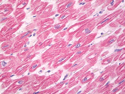 MYL2 Antibody (clone 7C9) - Mouse Monoclonal Antibody WB, IHC-P, E ...