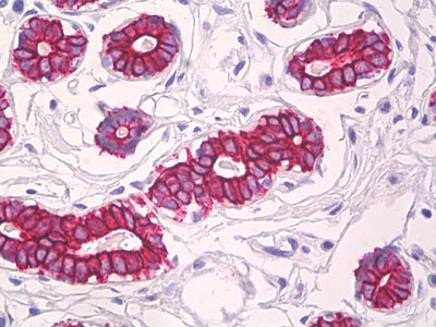 Pan Cytokeratin Antibody (clone PAN-CK) - Mouse Monoclonal Antibody IHC ...