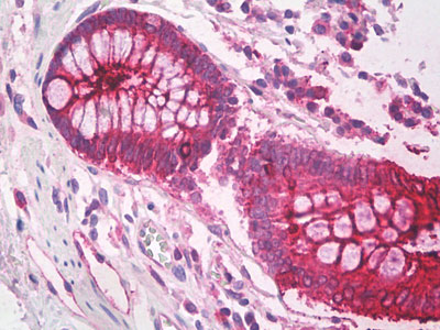 CEA / Carcinoembryonic Antigen Antibody - Rabbit Polyclonal Antibody WB ...