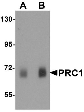 PRC1 Antibody (Internal) - Rabbit Polyclonal Antibody WB, IHC-P, IF ...