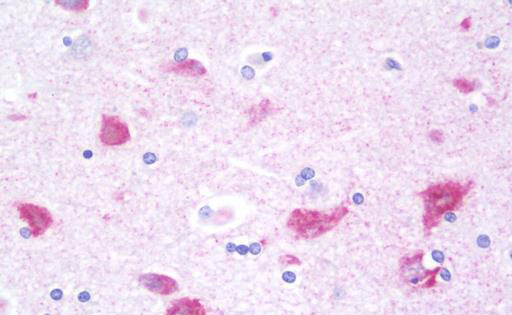 G3BP2 Antibody (aa433-482) - Rabbit Polyclonal Antibody WB, IHC-P, E ...