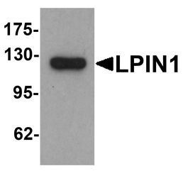 LPIN1 / Lipin 1 Antibody (C-Terminus) - Rabbit Polyclonal Antibody WB ...