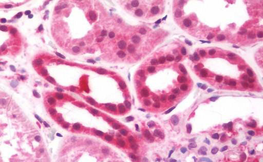 ODC1 / Ornithine Decarboxylase Antibody - Rabbit Polyclonal Antibody WB ...