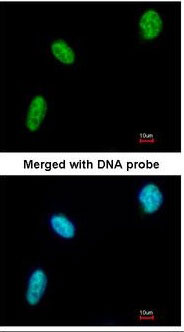 DDX39A Antibody (aa53-425) - Rabbit Polyclonal Antibody WB, IHC-P, ICC ...