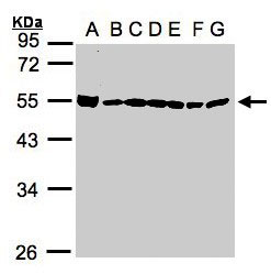 DDX39A Antibody (aa53-425) - Rabbit Polyclonal Antibody WB, IHC-P, ICC ...