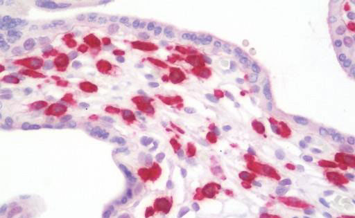 CD163 Antibody (clone 2C7) - Mouse Monoclonal Antibody WB, IHC-P, IF ...