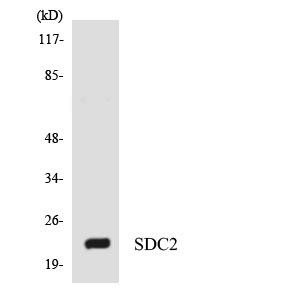 SDC2 / Syndecan 2 Antibody (aa65-114) - Rabbit Polyclonal Antibody WB, IHC-P, E - Buy Now! |Abcepta