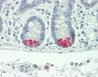 Trypsin Antibody - Rabbit Polyclonal Antibody IHC-P, E - Buy Now! |Abcepta