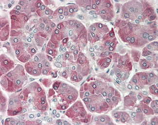 Trypsin Antibody - Rabbit Polyclonal Antibody IHC-P, E - Buy Now! |Abcepta