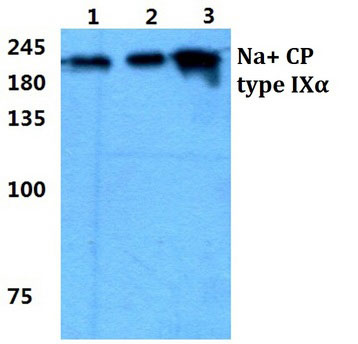 SCN9A / Nav1.7 Antibody (aa702-747) - Rabbit Polyclonal Antibody WB ...