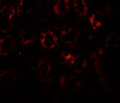 SLC1A7 / EAAT5 Antibody (C-Terminus) - Rabbit Polyclonal Antibody WB ...