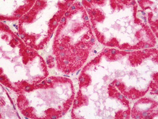 SLC1A7 / EAAT5 Antibody (C-Terminus) - Rabbit Polyclonal Antibody WB ...