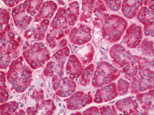 SLC1A7 / EAAT5 Antibody (C-Terminus) - Rabbit Polyclonal Antibody WB ...