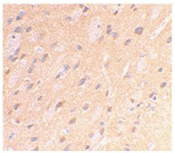 APP Antibody (CT) - Rabbit Polyclonal Antibody WB, IHC, E - Buy Now ...