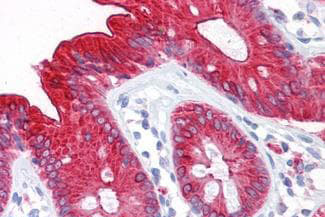 CEA / Carcinoembryonic Antigen Antibody (clone PARLAM 4) - Mouse ...