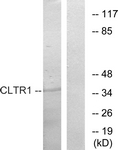 CYSLTR1 / CYSLT1 Antibody (aa131-180) - Rabbit Polyclonal Antibody WB ...