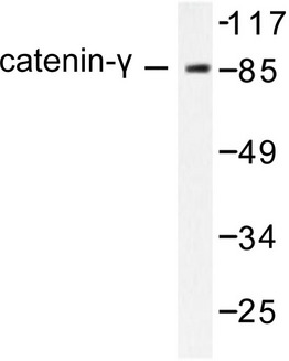 JUP/CTNNG/Junction Plakoglobin Antibody - Rabbit Polyclonal Antibody WB ...