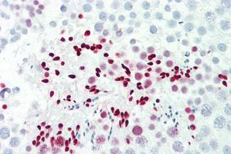 LDOC1L Antibody (aa141-190) - Rabbit Polyclonal Antibody WB, IHC-P, E ...