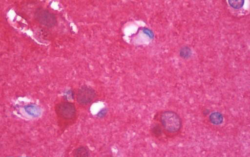 ENO2 / NSE Antibody - Chicken Polyclonal Antibody WB, IHC-P, ICC - Buy ...