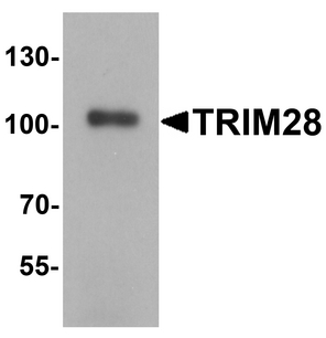TRIM28 / KAP1 Antibody (C-Terminus) - Rabbit Polyclonal Antibody WB ...