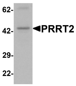 PRRT2 Antibody (Internal) - Rabbit Polyclonal Antibody WB, IHC-P, IF, E ...