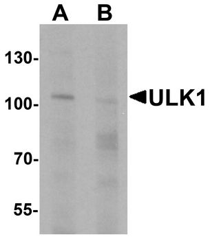 ULK1 Antibody (Internal) - Rabbit Polyclonal Antibody WB, IHC-P, IF, E ...