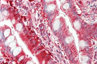 CHEK1 / CHK1 Antibody - Rabbit Polyclonal Antibody WB, IHC, IHC-P - Buy ...