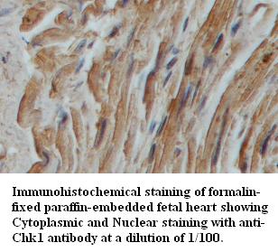 CHEK1 / CHK1 Antibody - Rabbit Polyclonal Antibody WB, IHC, IHC-P - Buy ...