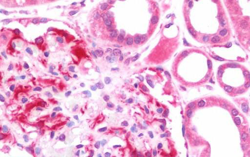 SCNN1A / ENaC Apha Antibody (aa182-459) - Rabbit Polyclonal Antibody ...