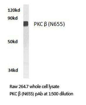 PRKCB / PKC-Beta Antibody (aa621-670) - Rabbit Polyclonal Antibody WB ...