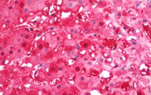 RDX / Radixin Antibody (aa142-191) - Rabbit Polyclonal Antibody WB, IHC ...