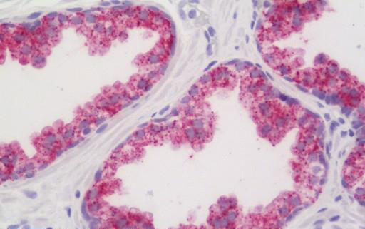 ARG2 / Arginase 2 Antibody (aa305-354) - Rabbit Polyclonal Antibody WB ...