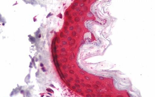 KRT5 / CK5 / Cytokeratin 5 Antibody (Synthetic peptide, corresponding ...