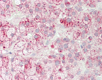 ME2 / Malate Dehydrogenase 2 Antibody (Internal) - Rabbit Polyclonal ...