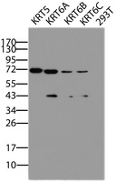 KRT5 / CK5 / Cytokeratin 5 Antibody (clone 4H8) - Mouse Monoclonal ...