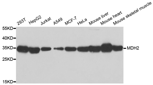 MDH / MDH2 Antibody - Rabbit Polyclonal Antibody WB, IHC-P, IF - Buy ...