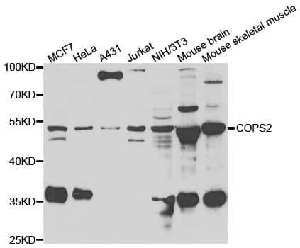 COPS2 / TRIP15 / ALIEN Antibody - Rabbit Polyclonal Antibody WB, IHC-P ...