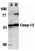 Caspase-12 Antibody - WB, IHC-P, E - Buy Now! |Abcepta