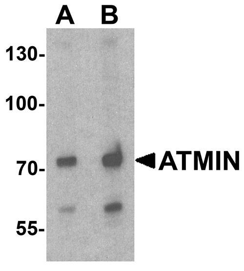 ATMIN Antibody - WB, IF, ICC, E - Buy Now! |Abcepta