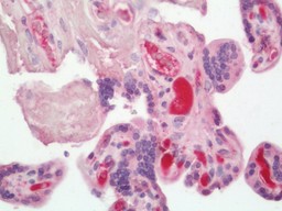 Anti-Complement C3 Antibody - Rabbit Anti Human Polyclonal Antibody WB ...