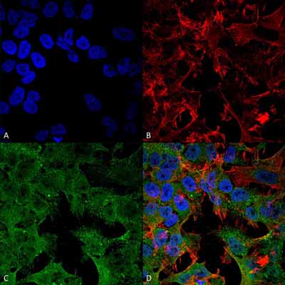 ADAM22 (cytoplasmic) Antibody - ADAM22 Antibody, Clone S46-30 WB, IHC ...