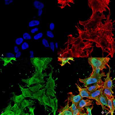 Alpha-2C Adrenergic Receptor Antibody - Alpha-2C Adrenergic Antibody ...