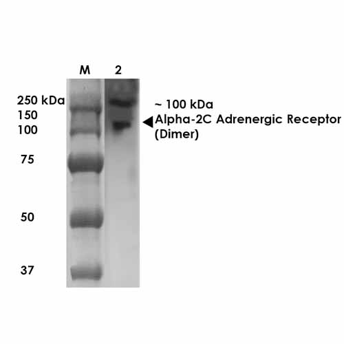 Alpha-2C Adrenergic Receptor Antibody - Alpha-2C Adrenergic Antibody ...