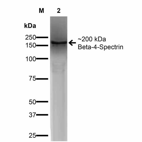 beta 4 Spectrin Antibody - beta 4 Spectrin Antibody, Clone S393-2 WB ...