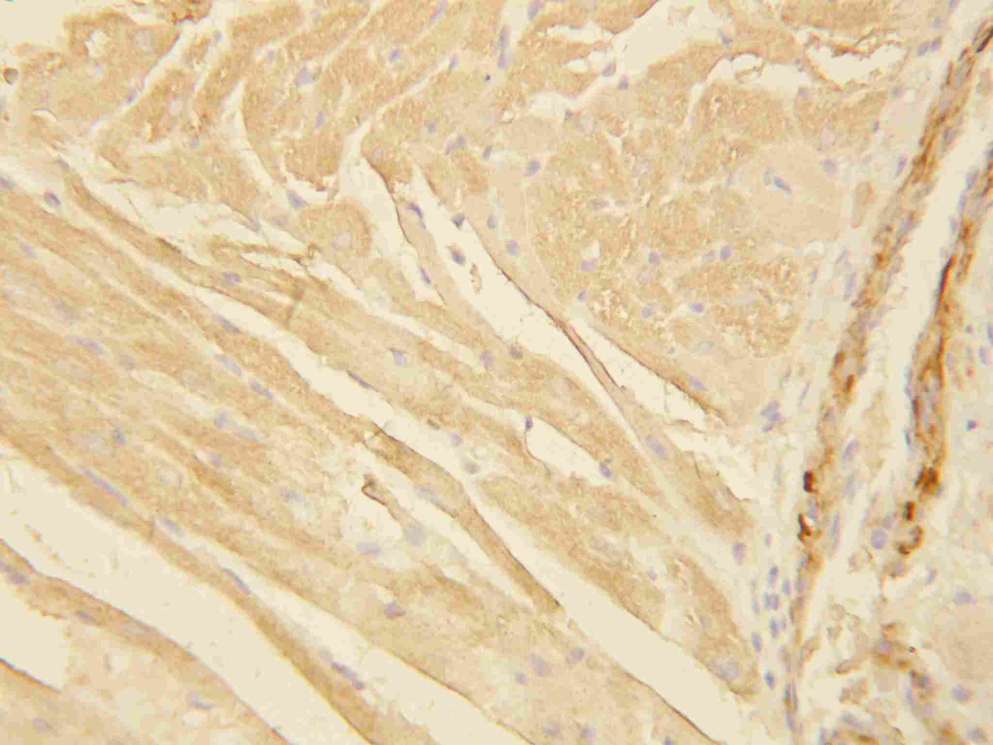 Anti-Actin Antibody - WB, IHC-P - Buy Now! |Abcepta