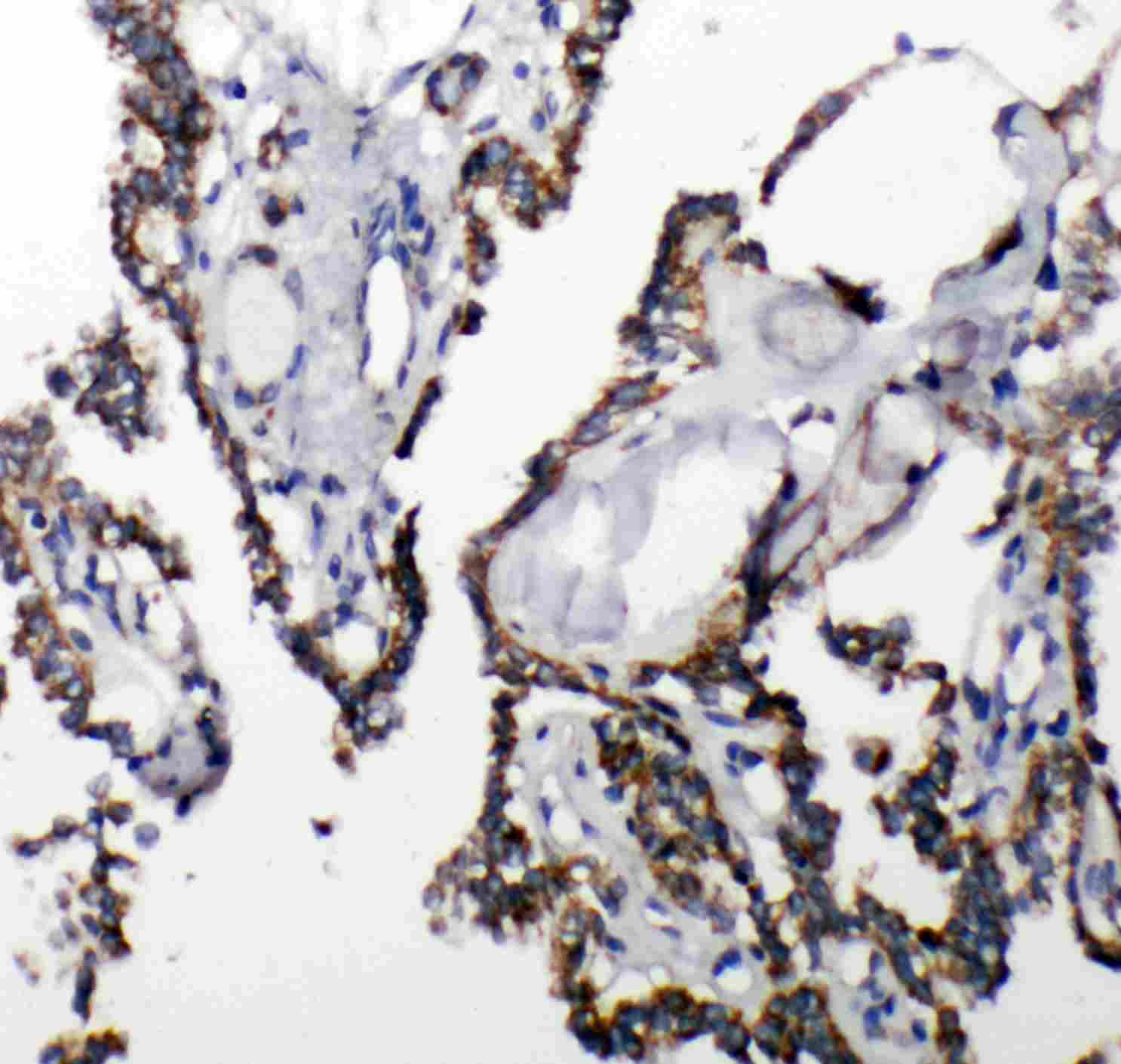 Anti-TSH Receptor Antibody - WB, IHC-P - Buy Now! |Abcepta