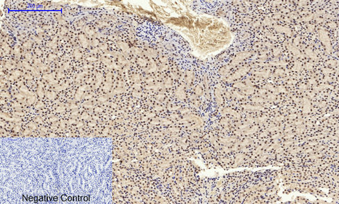 NFκB-p65 (phospho Ser529) Polyclonal Antibody - WB, IHC-P, IF - Buy Now ...