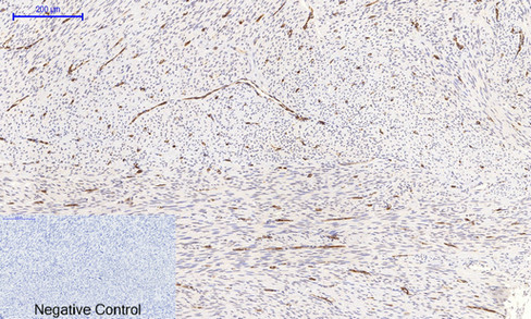 NFκB-p65 (phospho Ser536) Polyclonal Antibody - WB, IHC-P, IF, IP - Buy ...