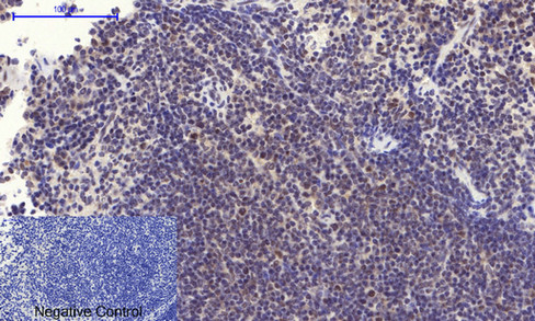 NFκB-p65 (phospho Ser536) Polyclonal Antibody - WB, IHC-P, IF, IP - Buy ...