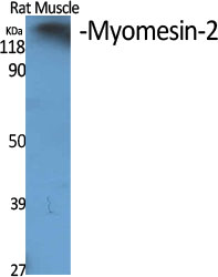 Myomesin-2 Polyclonal Antibody - WB - Buy Now! |Abcepta